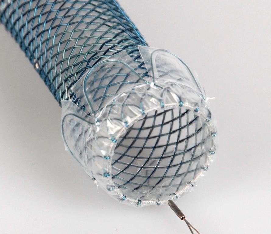 Danis stent - Stentit - Kebomed