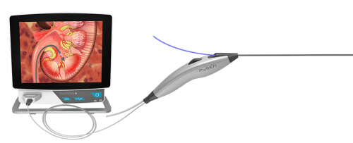 Pusen Medical Utereroscope UE3011 - Urologia - Kebomed